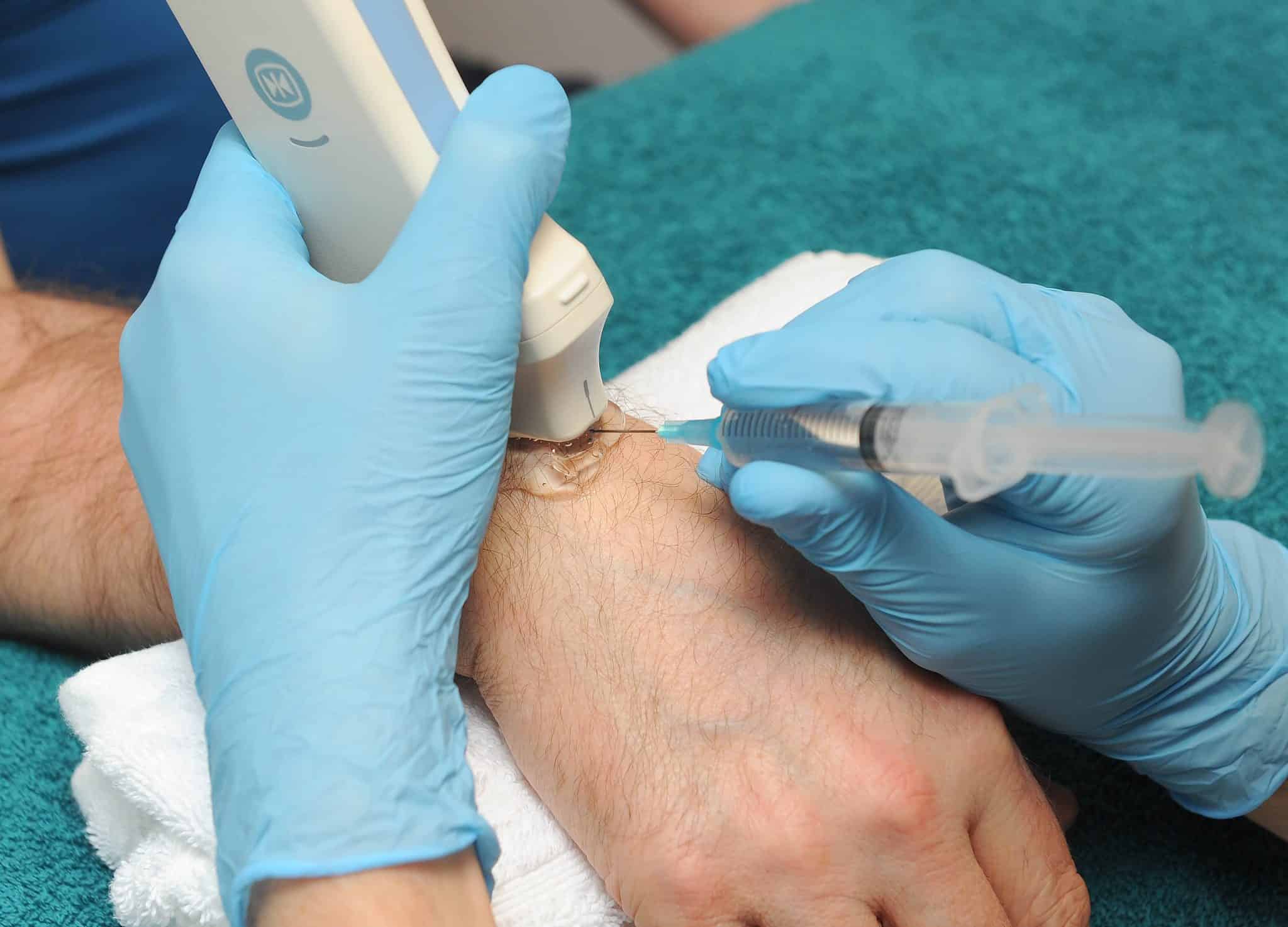 Do You Need to Rest After a Cortisone Injection? - Life Fit Wellness